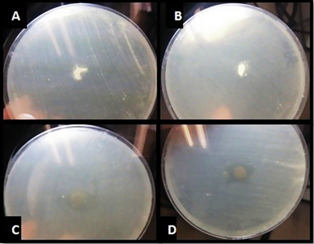 Antibacterial Activity Analysis of Hydroxyapatite Based Materials with ...