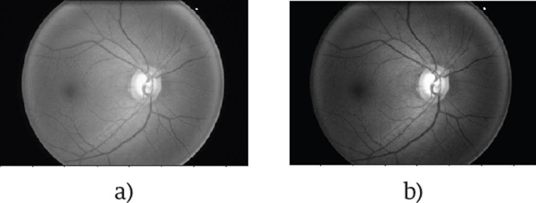 Image-based Glaucoma Classification Using Fundus Images and Deep Learning