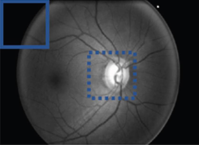 Image-based Glaucoma Classification Using Fundus Images and Deep Learning