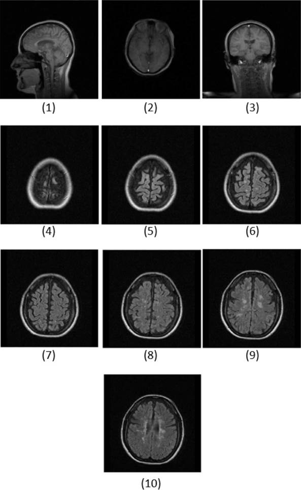 Secure Exchange of Medical Images Via Extended Visual Cryptography