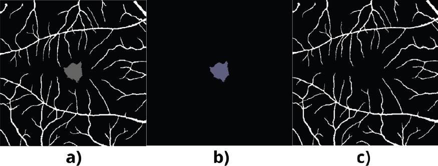 Segmentation of OCT and OCT-A Images using Convolutional Neural Networks