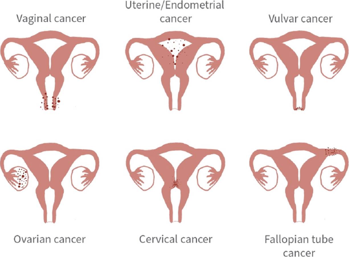 Mucoadhesive polymeric systems for vaginal drug delivery: a systemic review