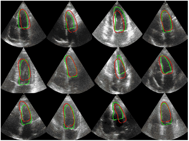 A U-Net with Statistical Shape Restrictions Applied to the Segmentation ...