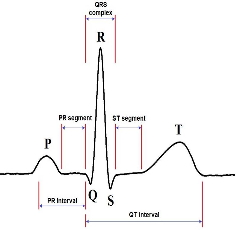 A Novel Detector of Atypical Beats for Early Diagnosis of Heart ...