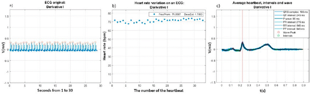 A Novel Detector of Atypical Beats for Early Diagnosis of Heart ...