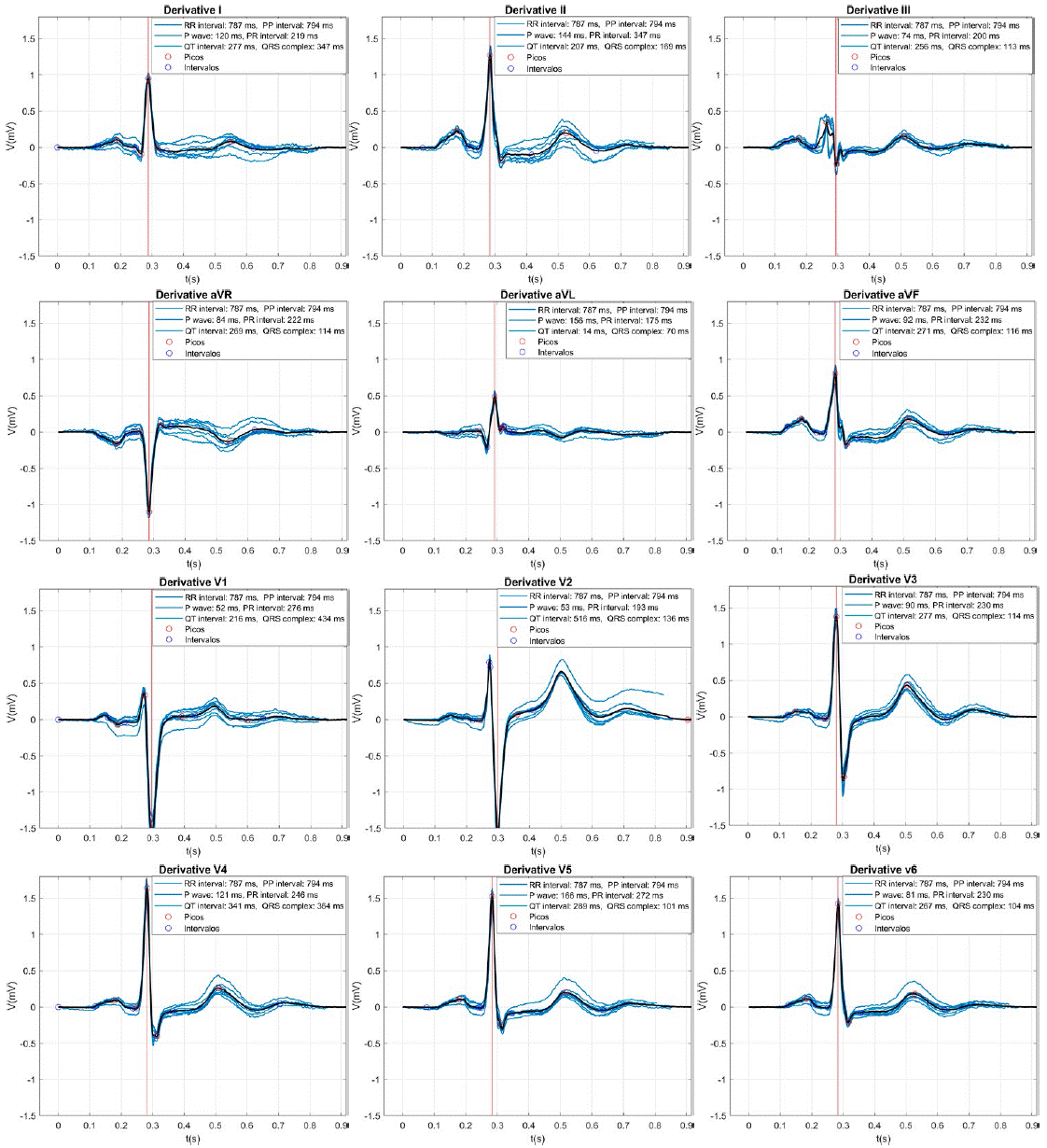 A Novel Detector of Atypical Beats for Early Diagnosis of Heart ...