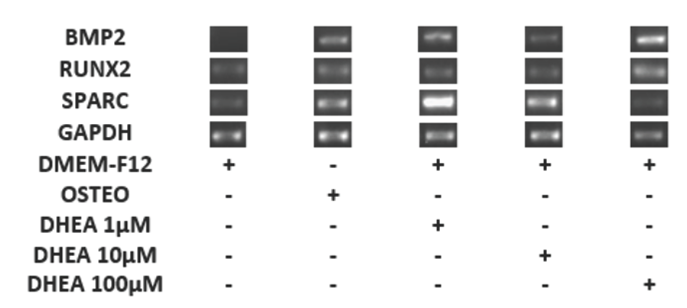 Effect of dehydroepiandrosterone on expression of BMP2, SPARC and RUNX2 ...
