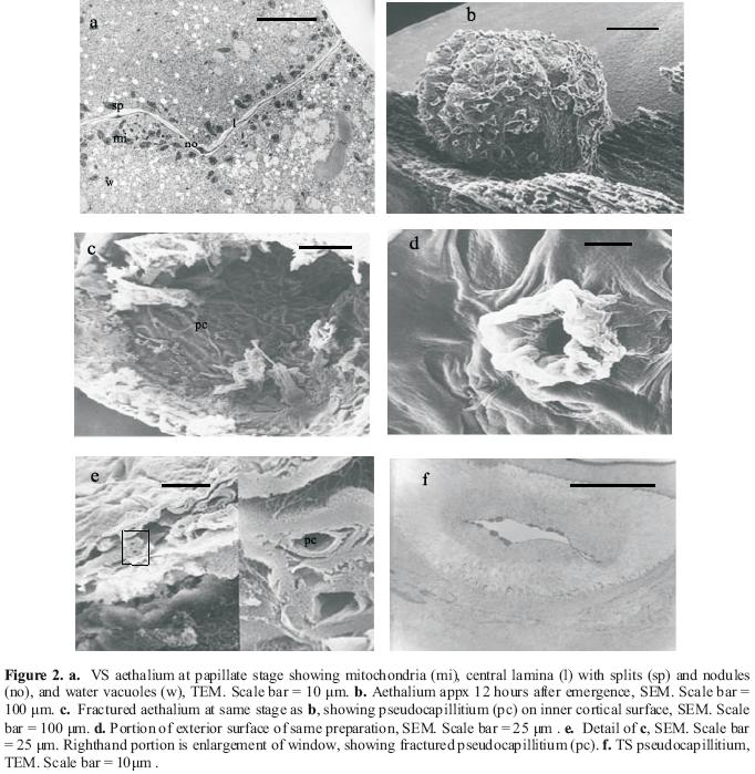 Aethalium cortex formation in the myxomycete Lycogala terrestre