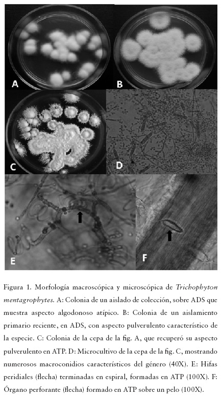 Reactivación morfológica de algunas especies de dermatofitos y su ...