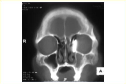 Oftalmología en imágenes