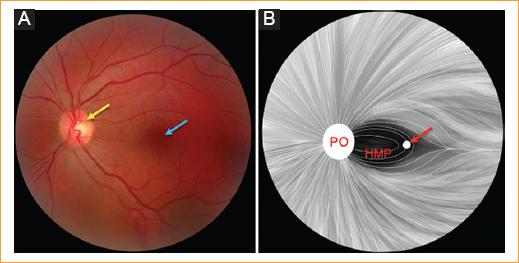 Actualización desde la anatomía funcional y clínica del sistema visual ...