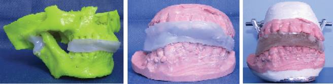 Anquilosis temporomandibular en pacientes pediátricos