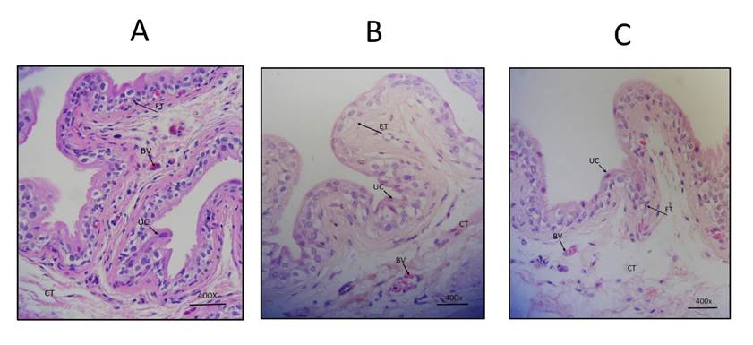 The effect of a super-oxidized solution on the bladder uroepithelium of ...
