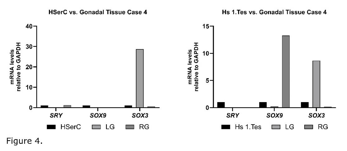 Cytogenetic and molecular characterization in gonadal tissue of ...