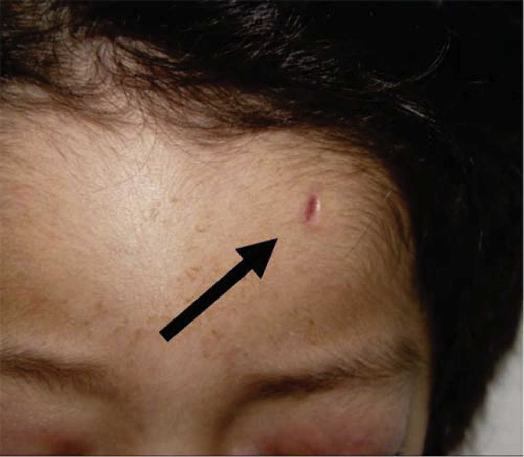 Síndrome de niño maltratado con repercusión estomatológica. Reporte de ...