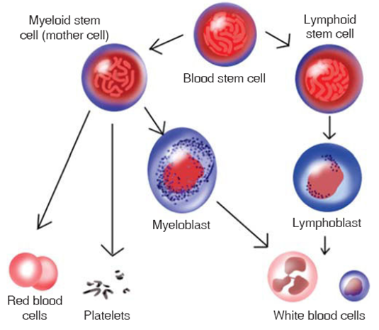 Lymphoblast Vs Myeloblast