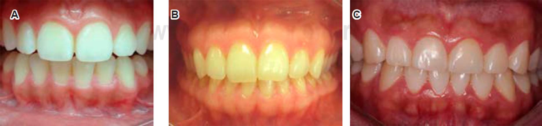 Clasificación de enfermedades y condiciones periodontales y ...