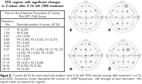 Clinical and electrophysiological effect of right and left repetitive ...