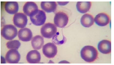 Enfermedad de Chagas: biología y transmisión de Trypanosoma cruzi