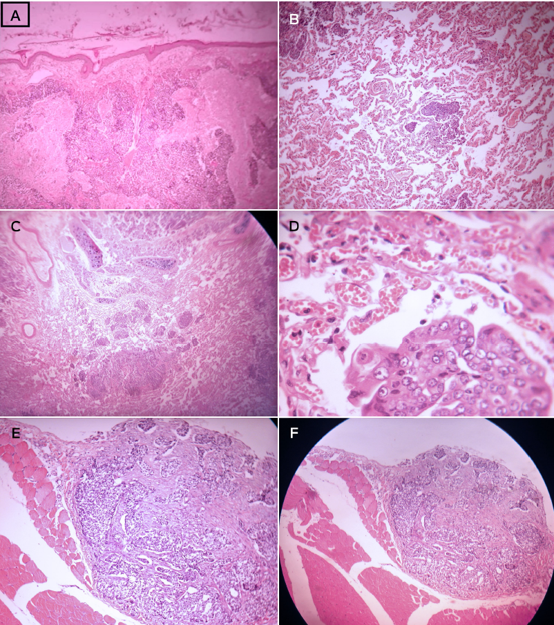 Detection of mammary adenocarcinoma metastases in a cat through 99mTc ...