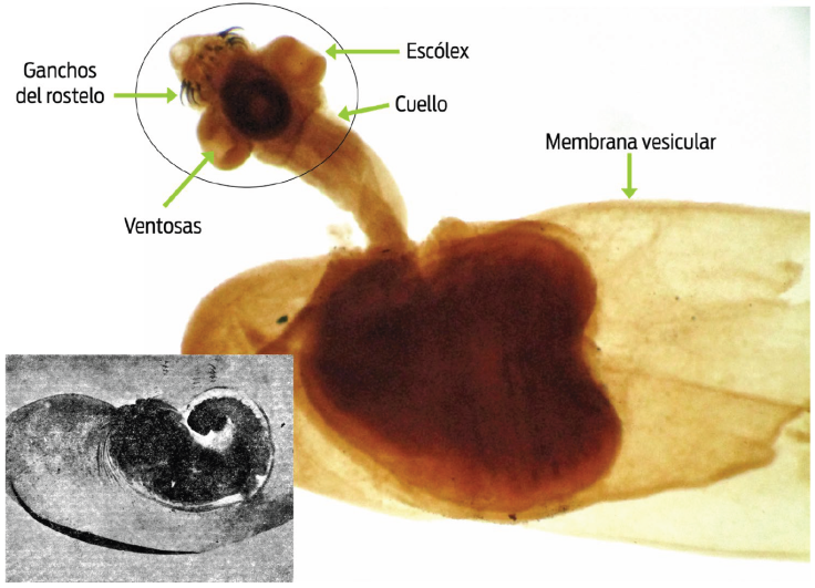 Presentación de un caso clínico de cisticercosis cerebral tratado ...